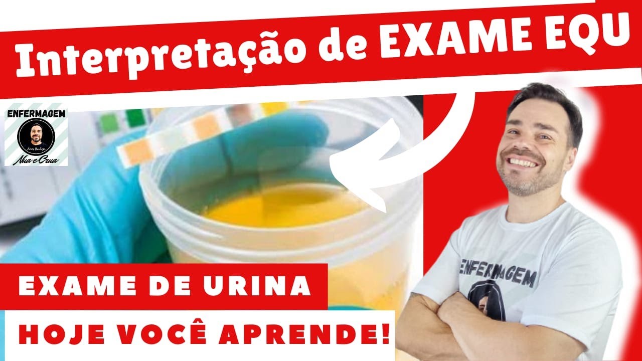 EQU - Como realizar a Interpretação do EXAME de URINA - Enfermagem Nua ...