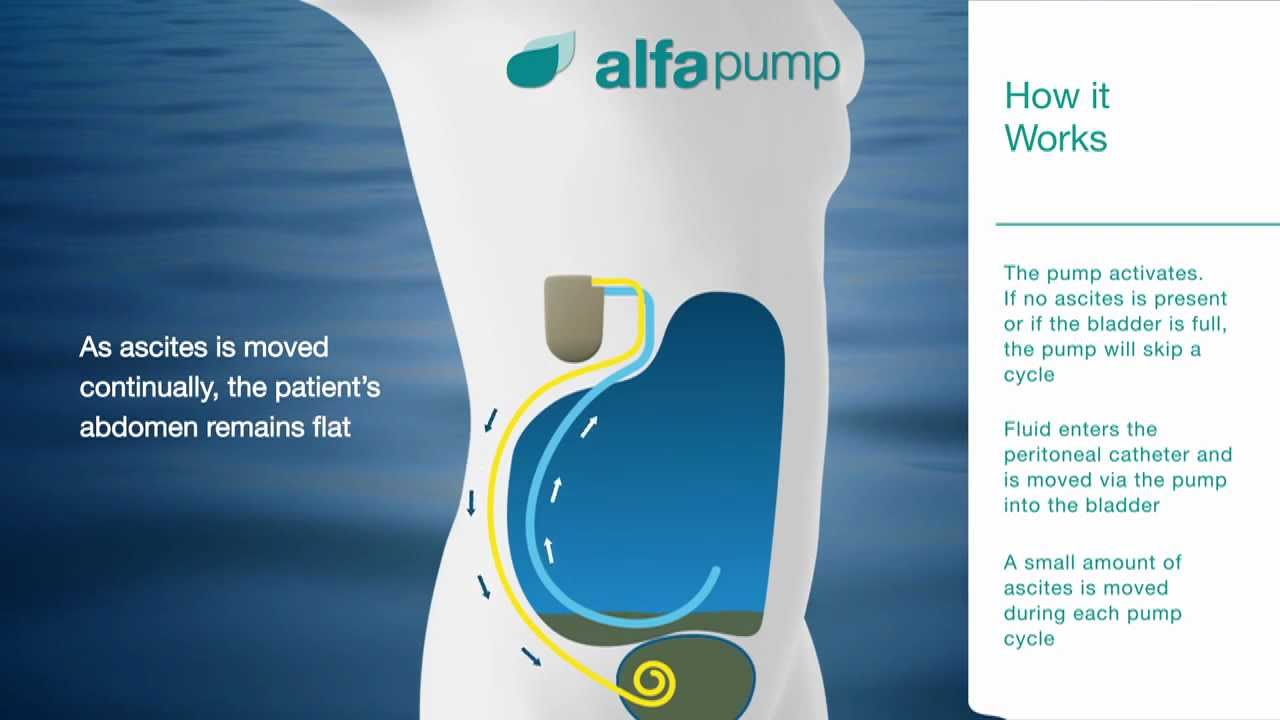alfapump® animation - YouTube