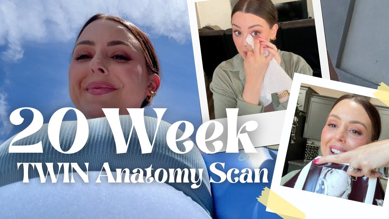 20 Week TWIN Anatomy Scan VLOG | Easy Smoothie, Pilates, Feeling So ...