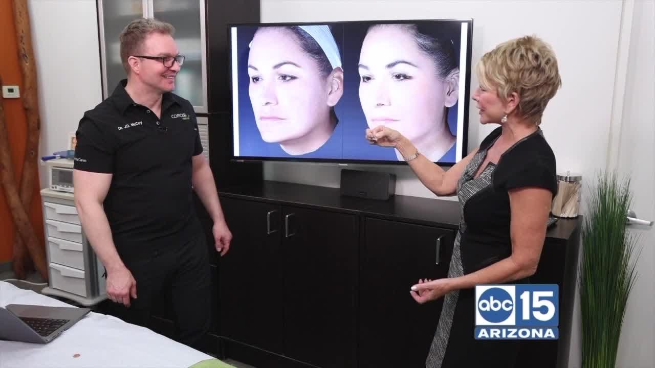 Contour Medical: Get a facelift without having surgery! - YouTube
