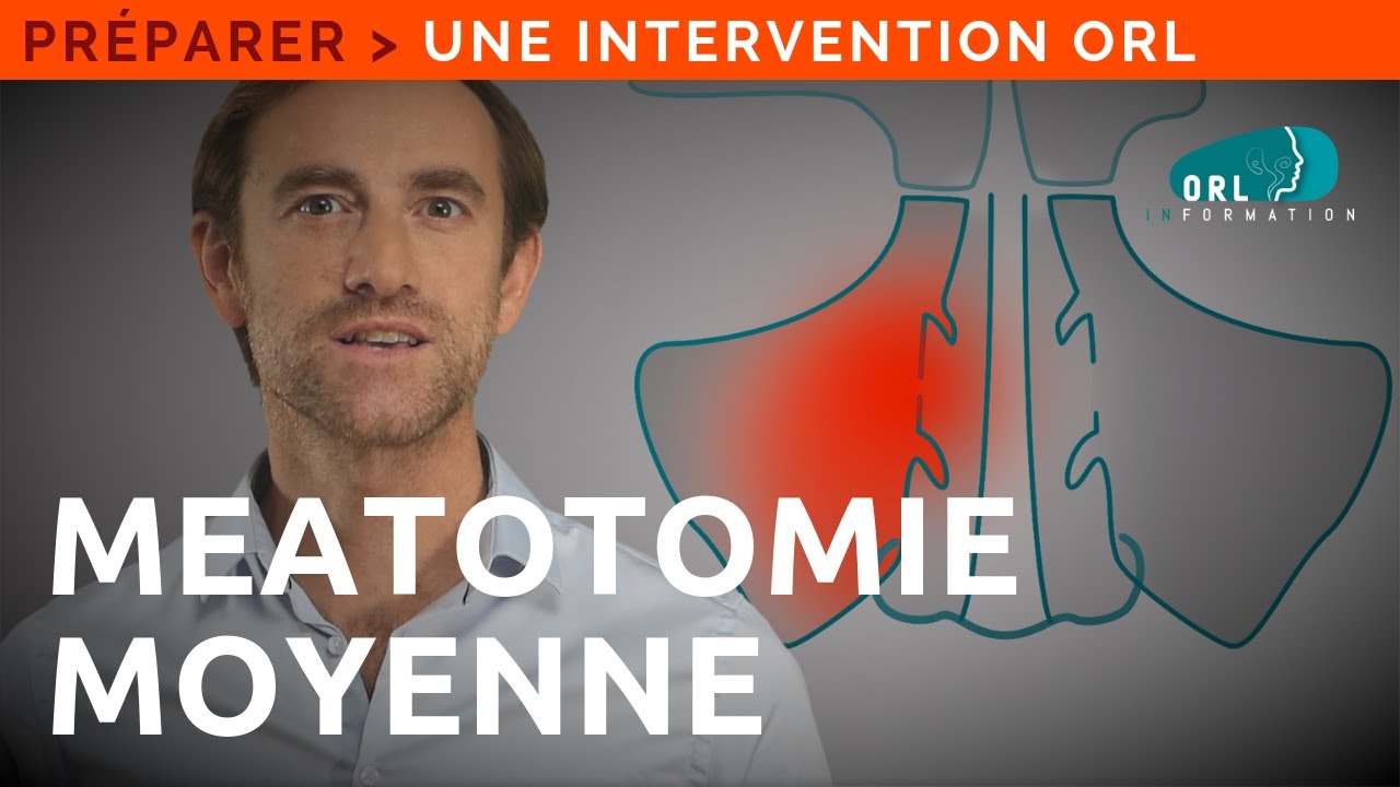 Information Patient | Chirurgie du nez (ouverture des sinus maxillaires ...