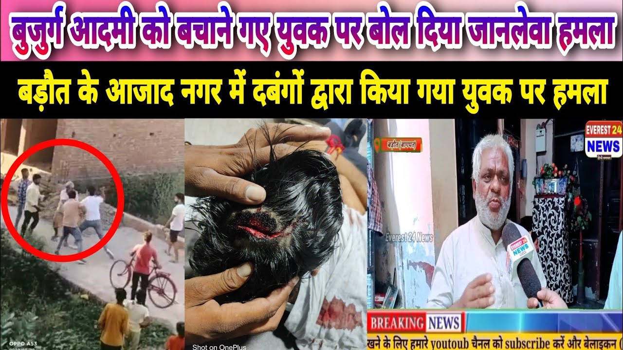 Baraut :- बुजुर्ग आदमी को बचाने गए युवक पर बोल दिया जा*नलेवा ह*मला ...