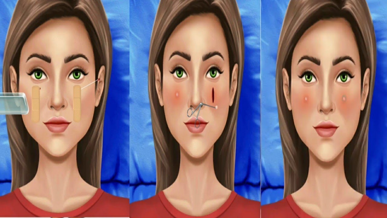 ASMR Face Pimples Cleaning Surjery Treatment asmr video - YouTube