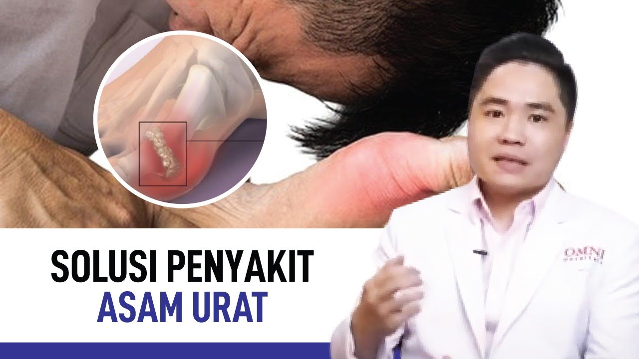 Penyakit Asam Urat: Gejala, Penyebab dan Cara Mengatasinya | Kata ...