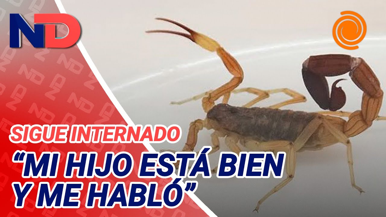 Lo picó un ALACRÁN y está INTERNADO hace una semana: despertó y pudo ...