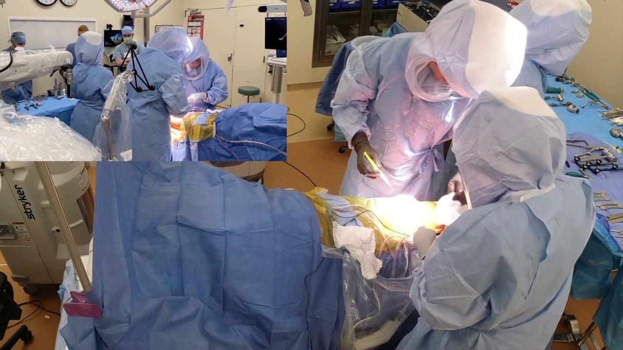 Mako Robotic Total Knee Replacement- Overview - YouTube