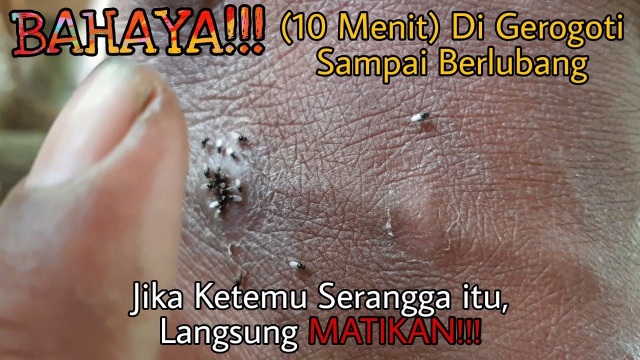 RENGiT - Serangga BAHAYA - Pemakan Koreng - YouTube