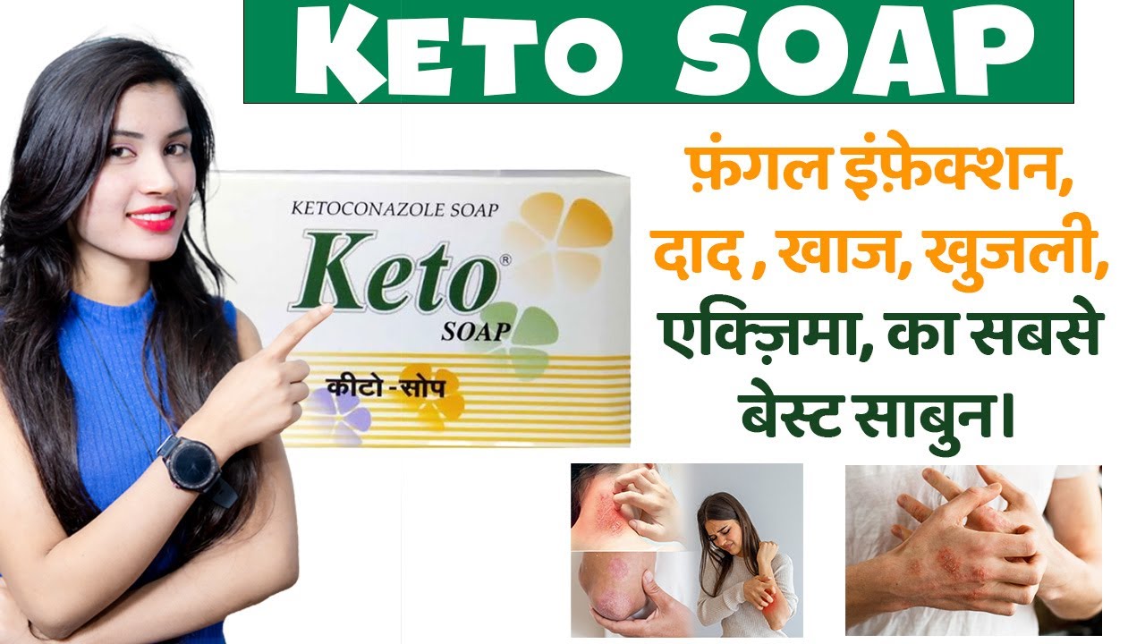 Keto Soap | Fungal skin infections | Side Effects | Review in Hindi ...