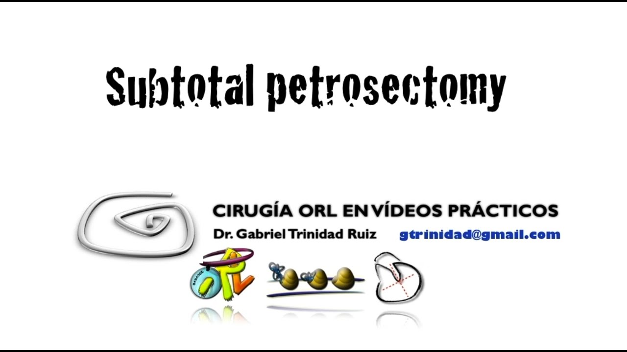SUBTOTAL PETROSECTOMY - YouTube