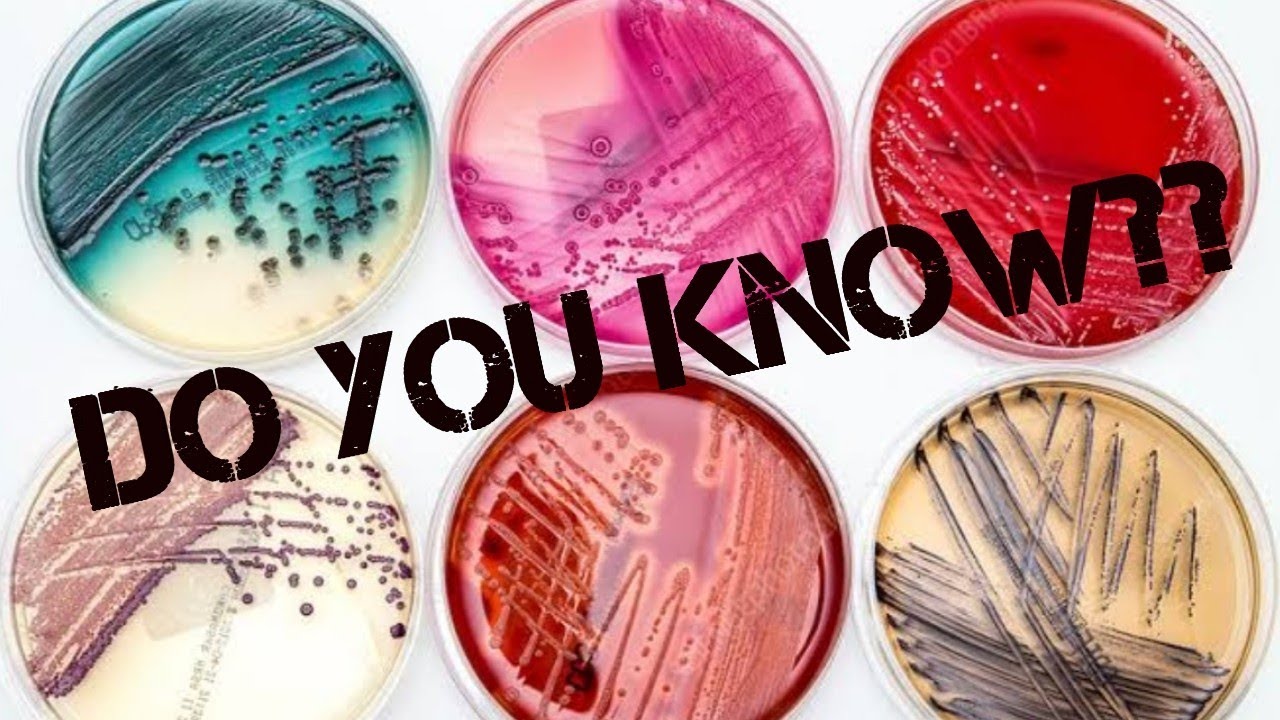 Culture media used in microbiology | Most commonly used solid agar ...