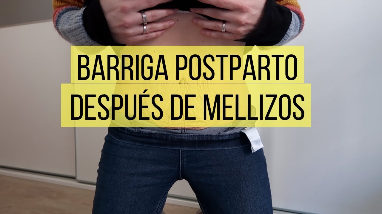 Mi BARRIGA postparto después del embarazo de MELLIZOS | Mamá ingeniera ...
