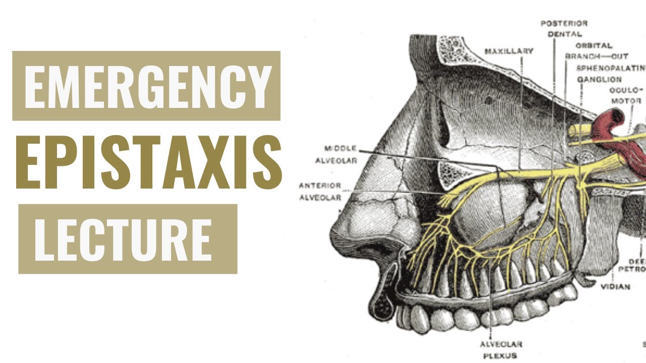 Epistaxis - Detailed explanation - Emergency Medicine - YouTube