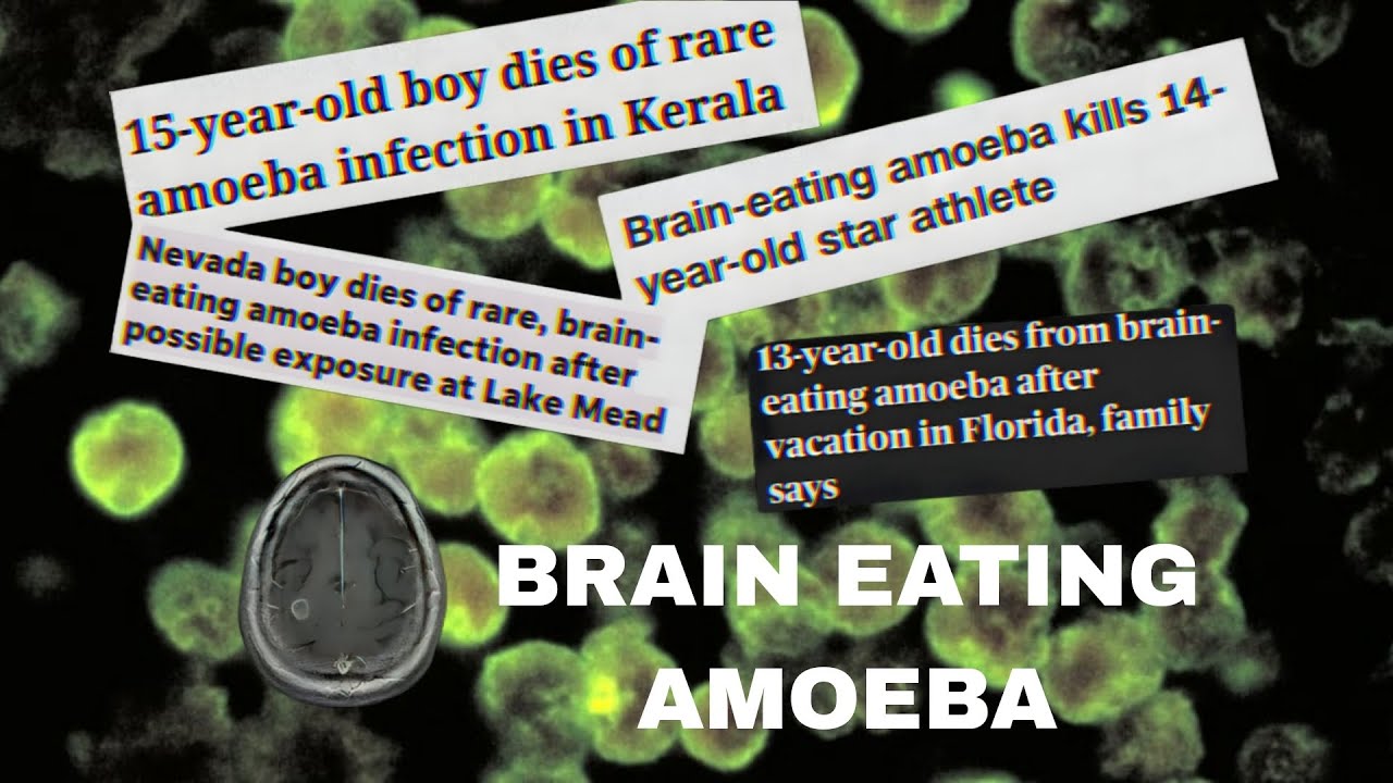 BRAIN EATING AMOEBA: Understanding the "Naegleria Fowleri".🧠 - YouTube