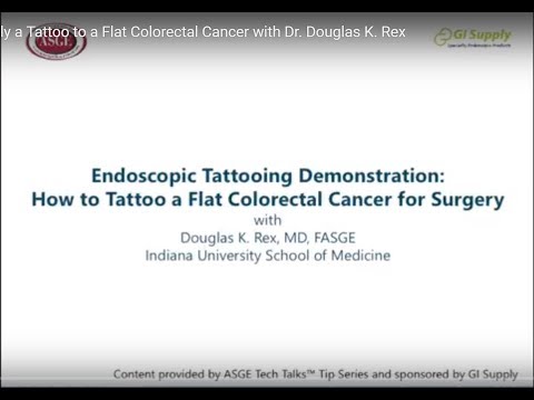 How To Do Tattoo In Colonoscopy