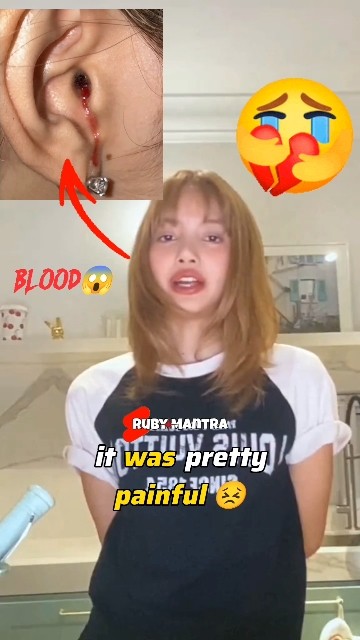 Lisa's ear injury was that bad 😰😢?? #lisa #blackpink #kpop #shorts #fyp ...