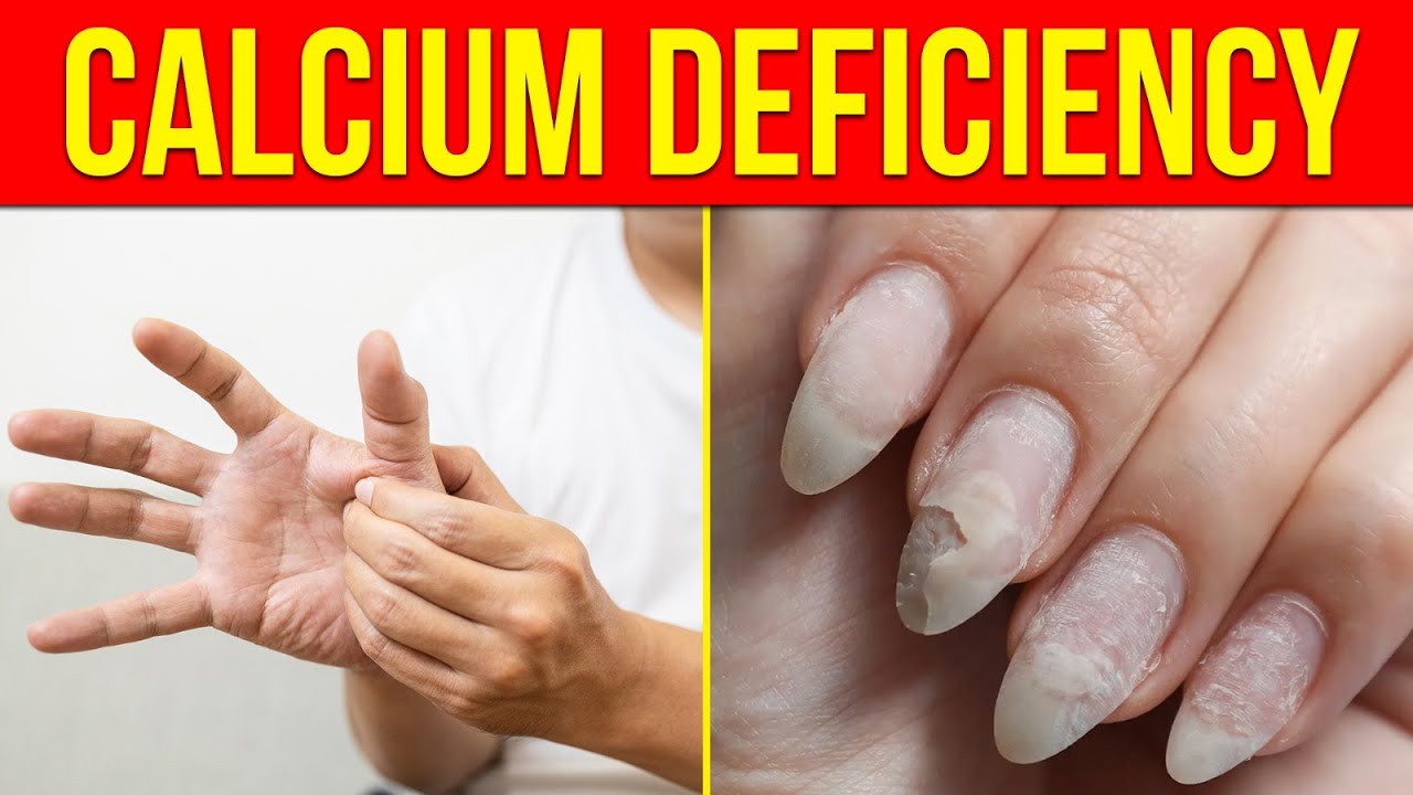 Unlocking the Secrets of Calcium Deficiency Symptoms, Risks, and ...