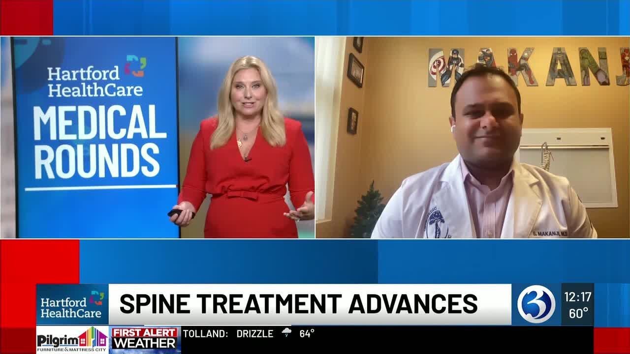 MEDICAL ROUNDS: Treating spine pain - YouTube