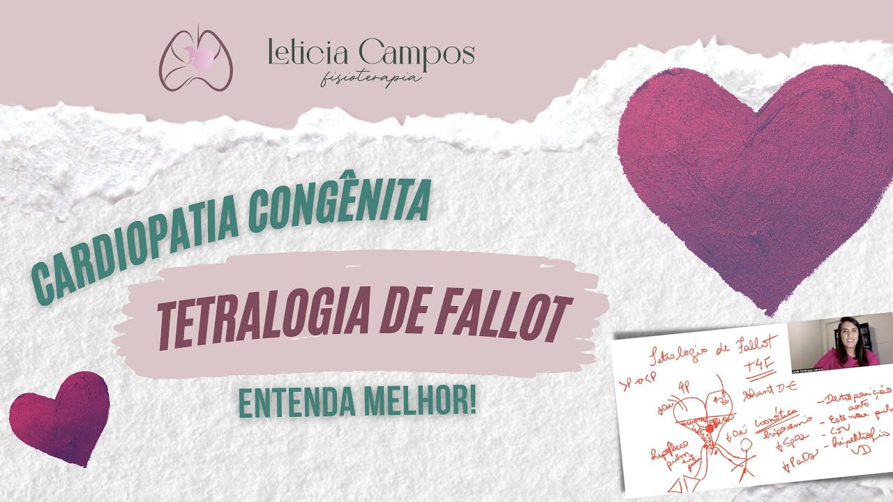 Tetralogia de Fallot: entenda melhor - YouTube