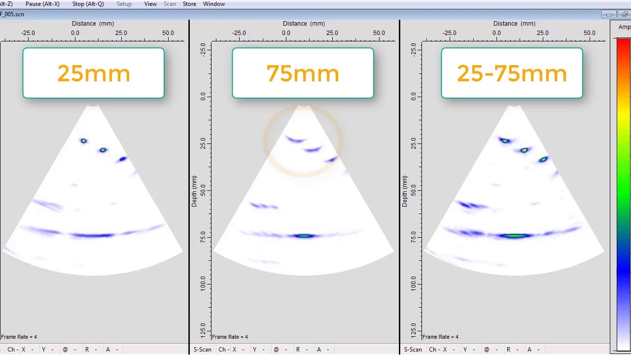Dynamic Depth Focusing - Technology Desing - YouTube