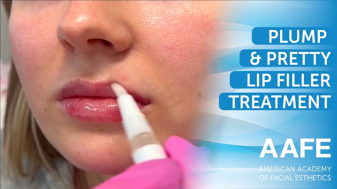 Plump and Pretty Lip Filler Treatment - YouTube