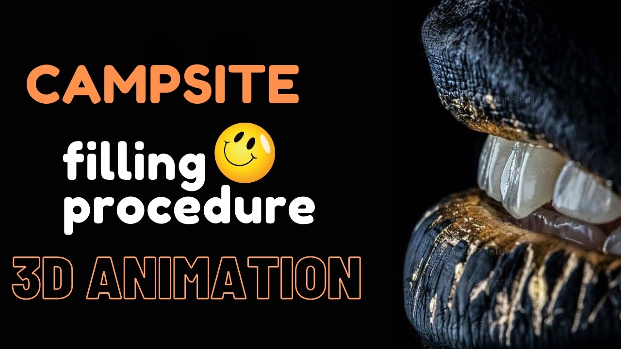 Step-by-Step Guide: Composite Filling Procedure || Dental Filling ...