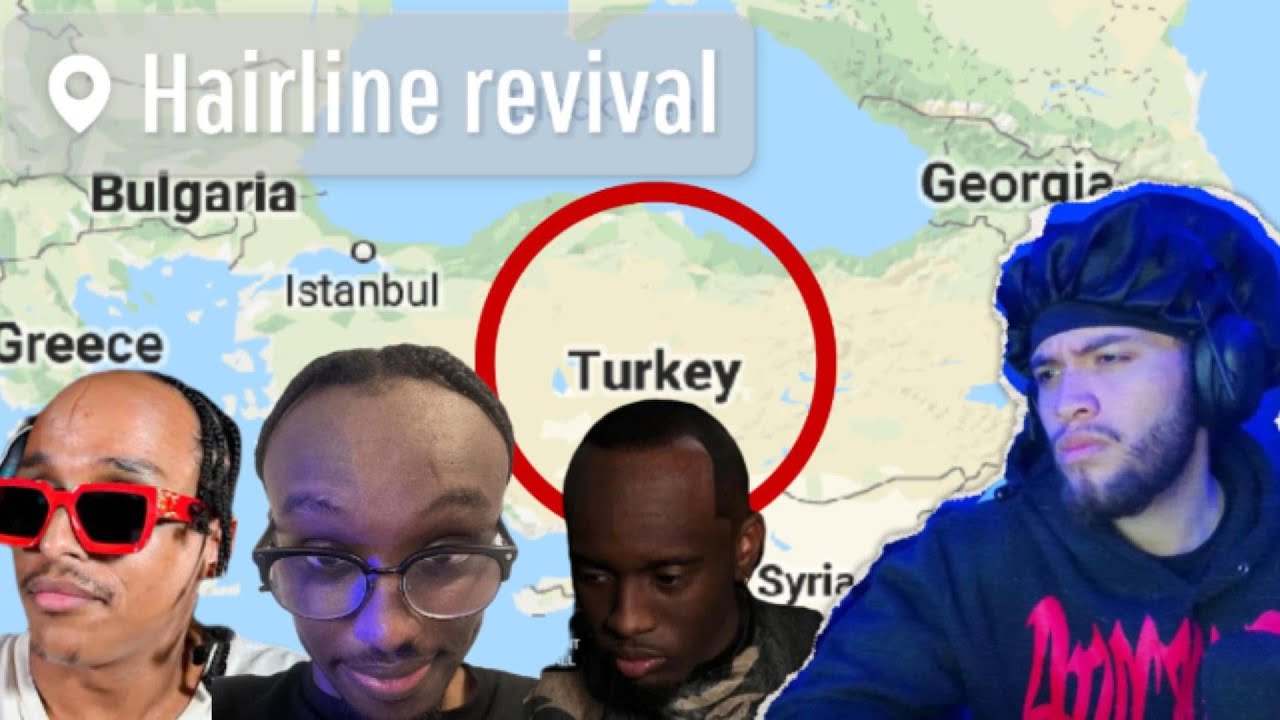 WHY DO STREAMERS HAVE BAD HAIRLINES?? - YouTube