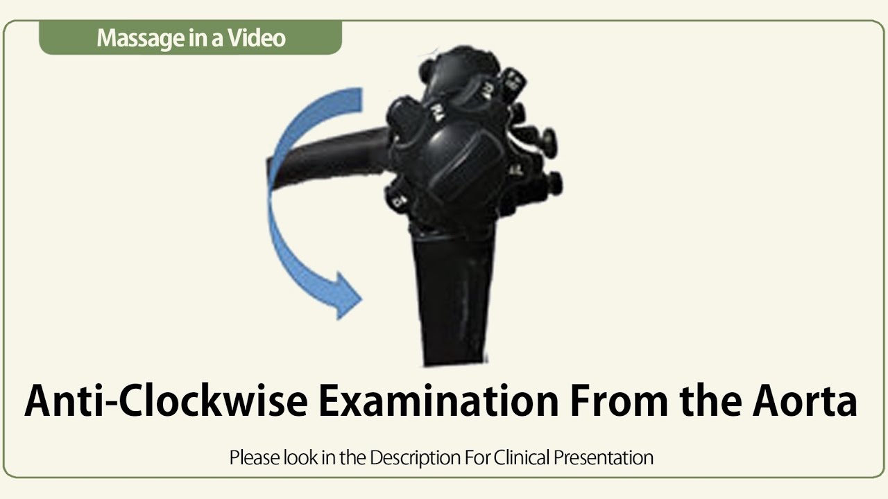 ACW Examination from the Aorta - YouTube