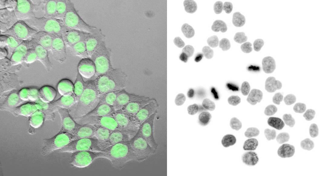 HCT116 H2B GFP 5 min - YouTube