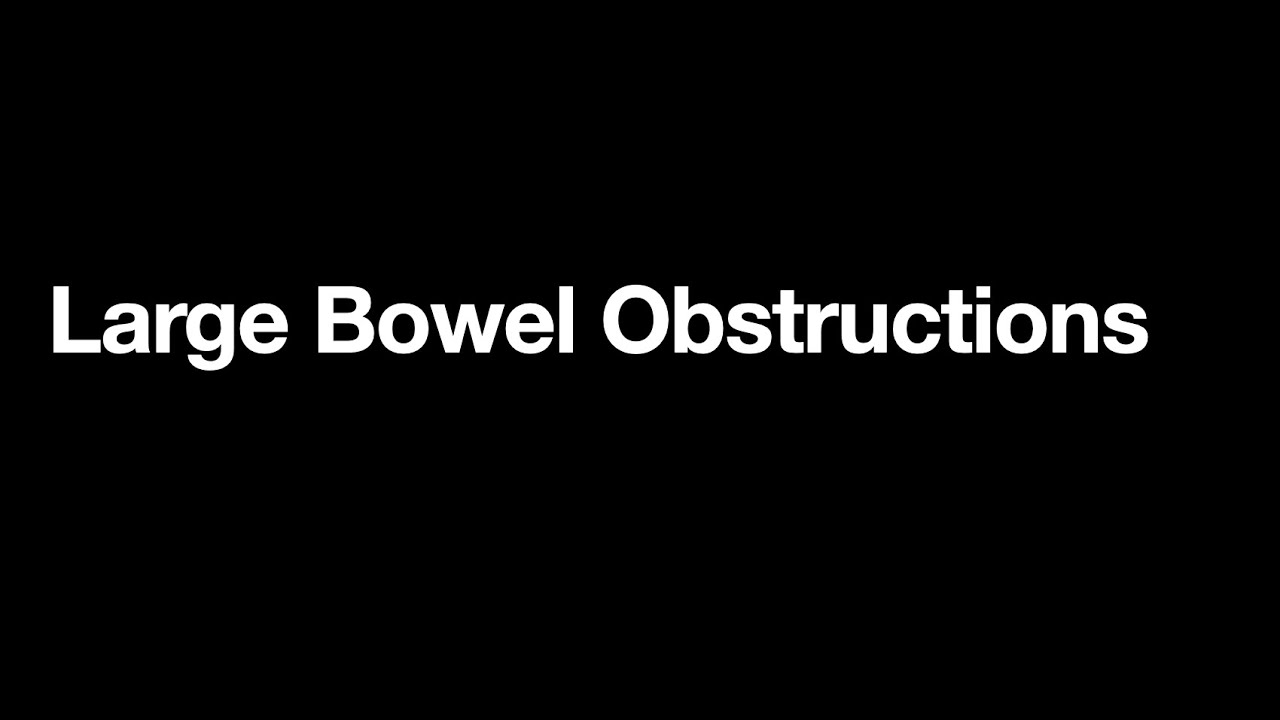 Large Bowel Obstructions Youtube