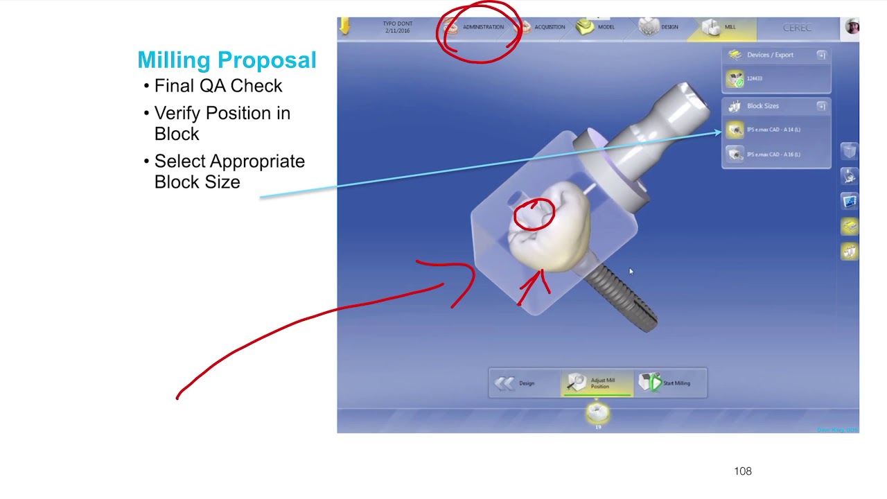 CEREC TiBase Lecture Series Lesson 07 - YouTube