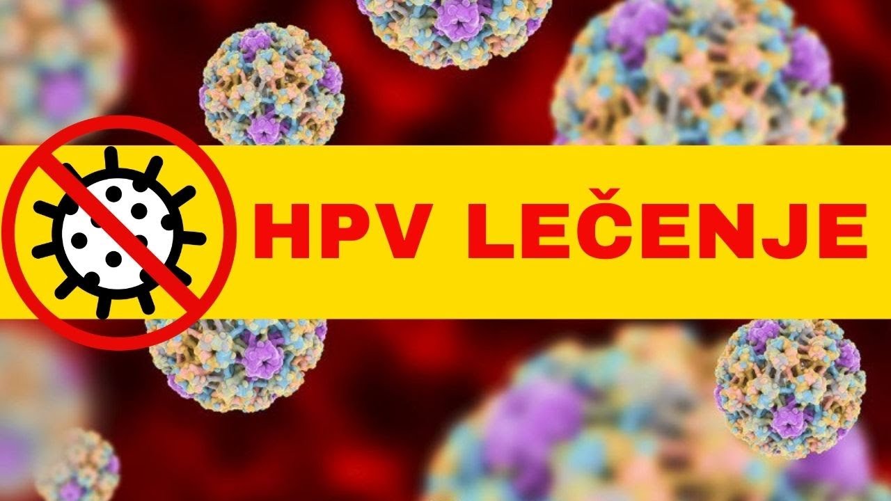 Sve o HPV virusu i njegovo lečenje - YouTube
