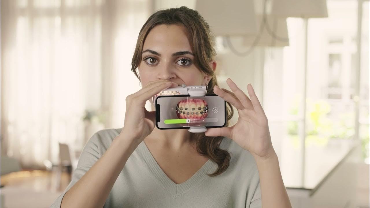 How to use ScanBox Pro with braces - A Patient's Guide - YouTube