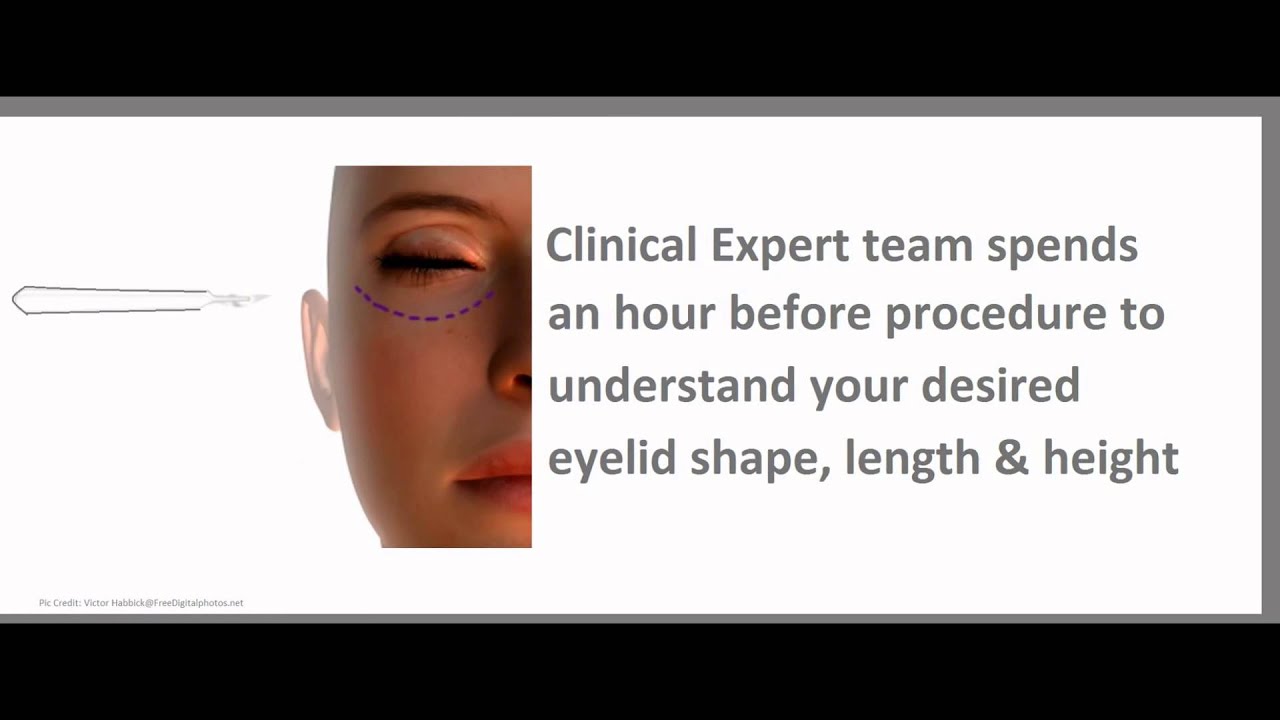 Eye Surgery Clinics Singapore | How to Change Eye Shape - YouTube
