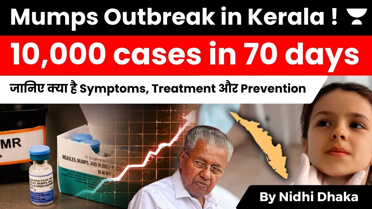 Mumps Outbreak in Kerala: Symptoms, Treatment, Prevention ,10,000 Cases ...