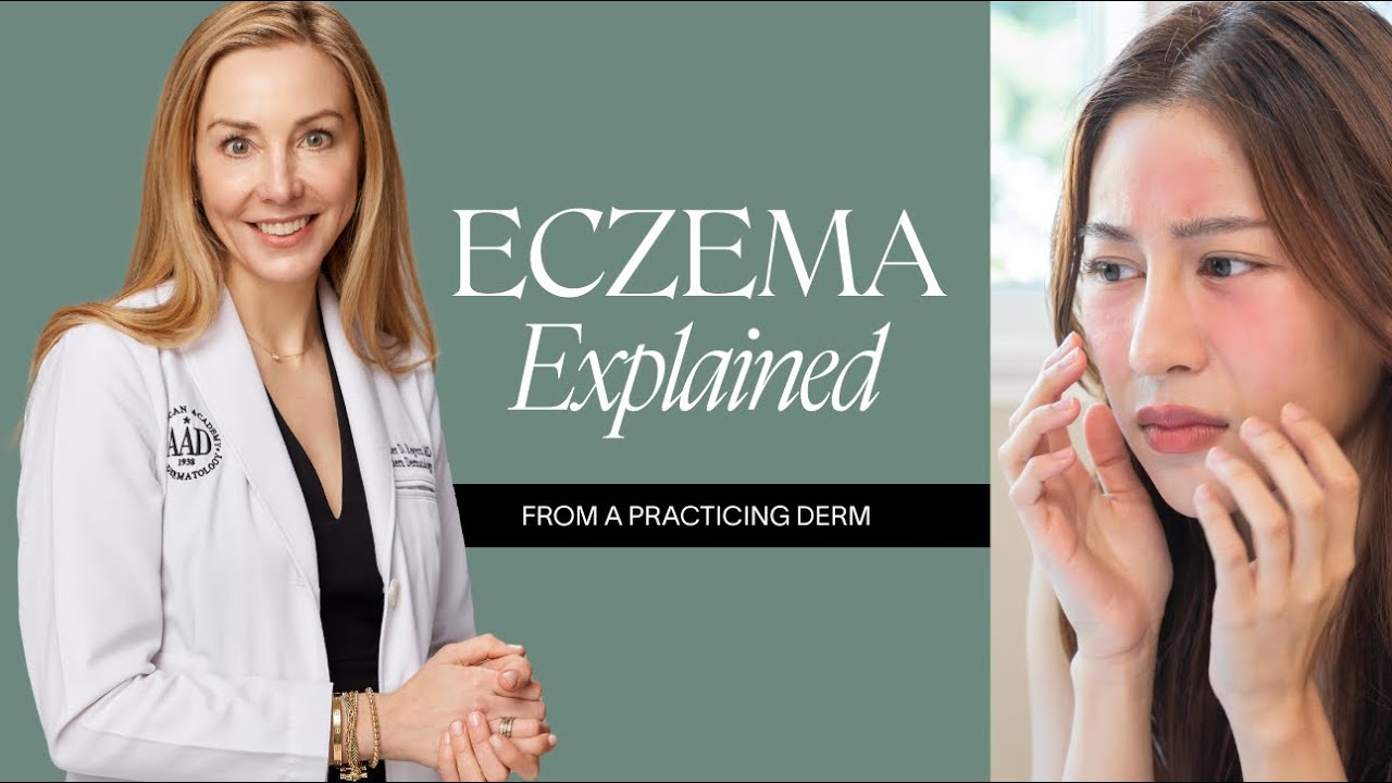 Eczema Tips + Expert Advice from a Dermatologist - YouTube