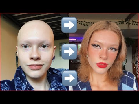 hair growth time lapse: 16 months post chemotherapy - YouTube