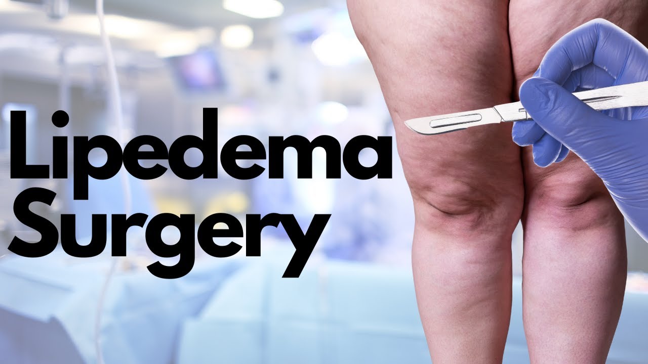 Lipedema Surgery - YouTube