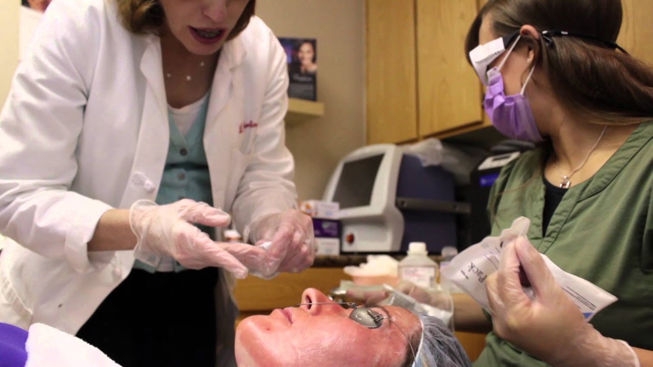 Microlaser Peel - YouTube