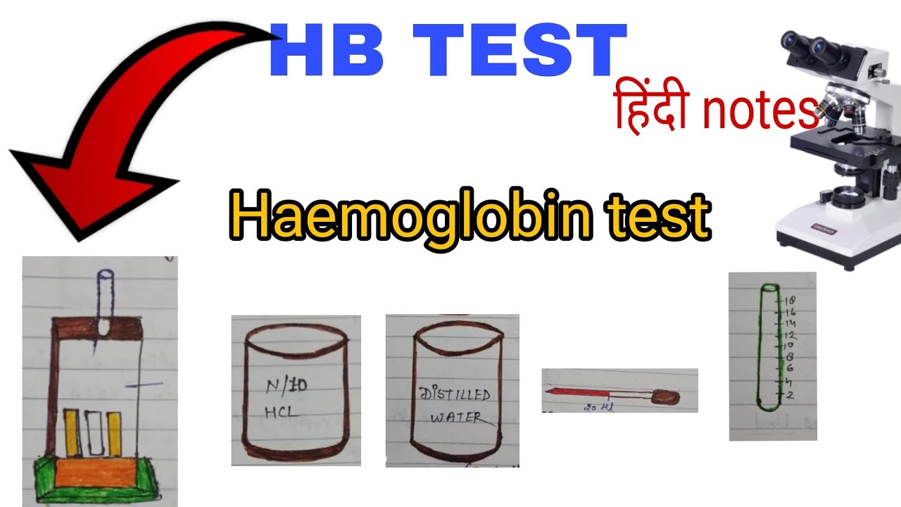 HB test haemoglobin test हिमोग्लोबिन टेस्ट हिन्दी नोट्स में #HB # ...