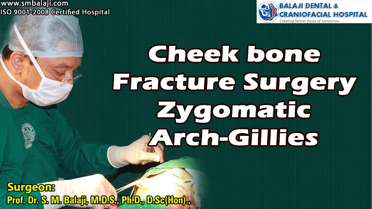 Zygomatic Arch Fracture Treatment