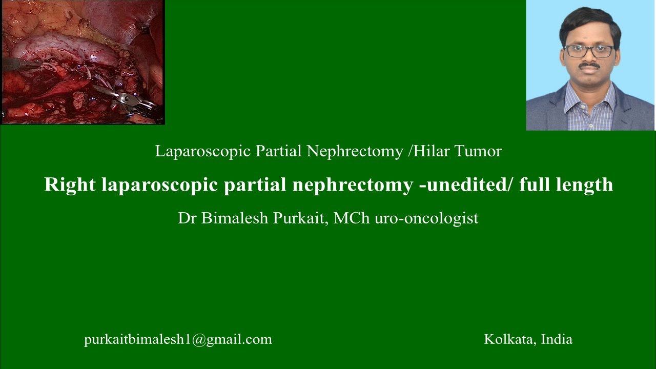 Laparoscopic Right Partial Nephrectomy / Lower Pole /Hilar tumor-Full ...