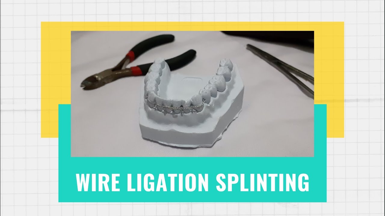 Splinting Gigi (Wire Ligation Splint) - YouTube