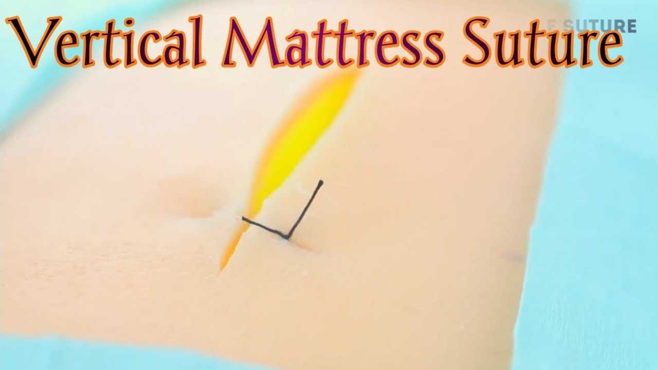 Vertical Mattress Suture ll Wound Suturing ll @trickynursingadda - YouTube