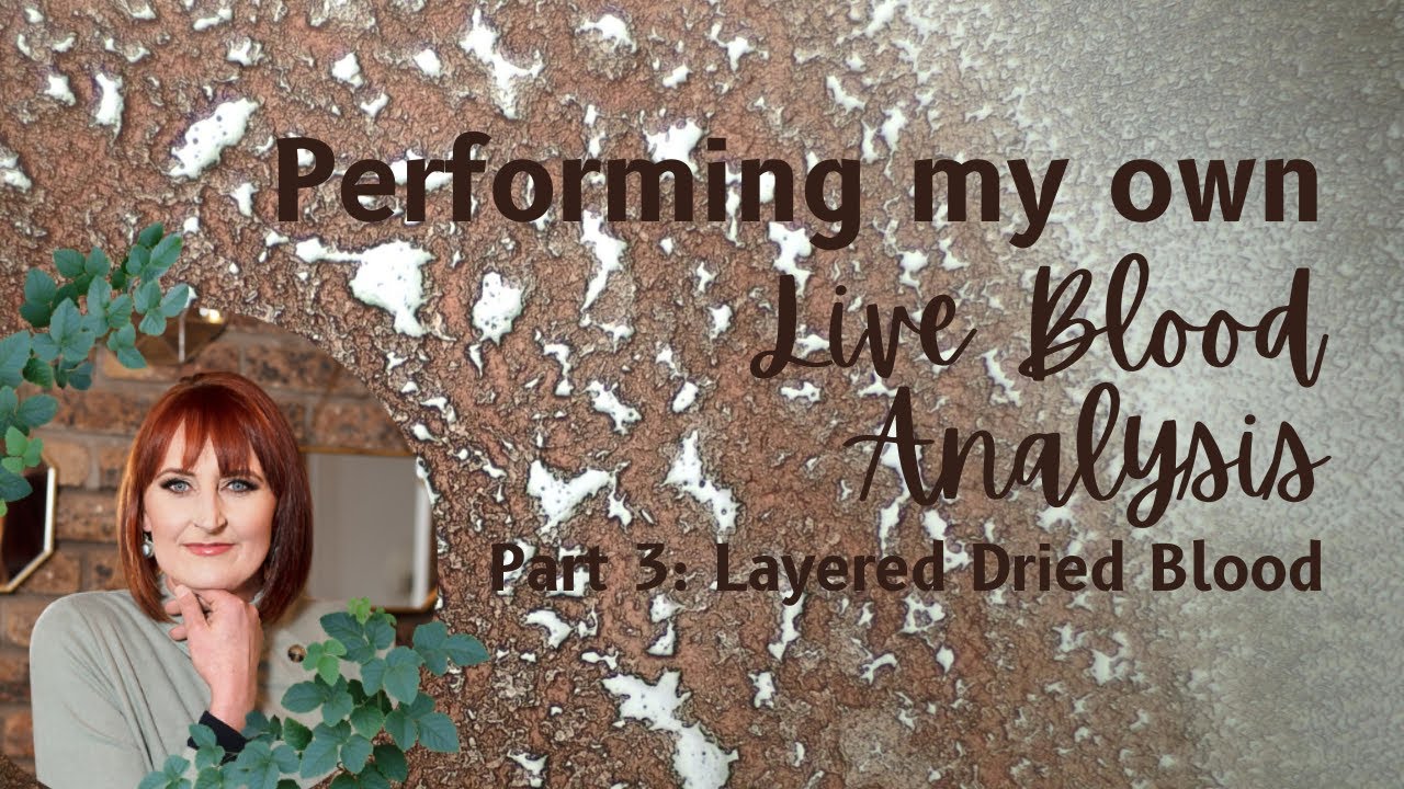 Performing Live Blood Analysis On My Own Blood - Part 3 - YouTube