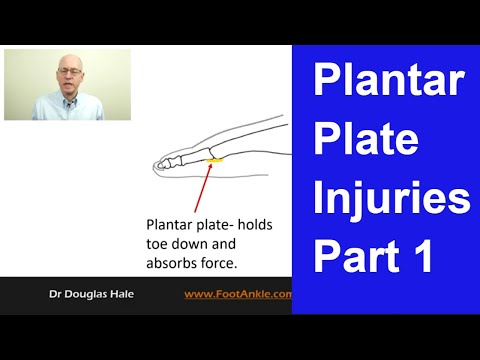 What Is A Planters Plate