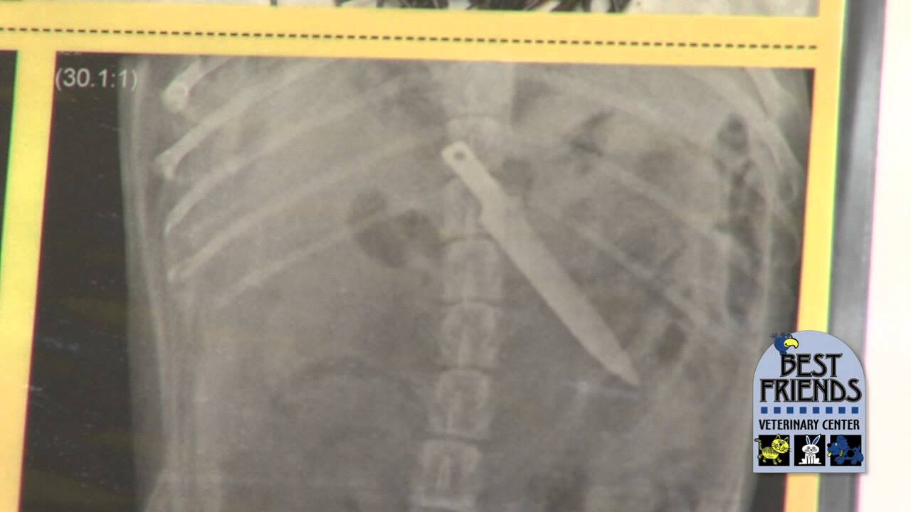 Foreign Body Ingestion - YouTube