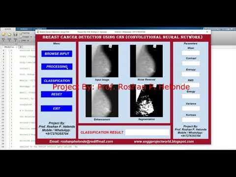 Breast Cancer Detection Using CNN | With Source Code | Matlab Project ...