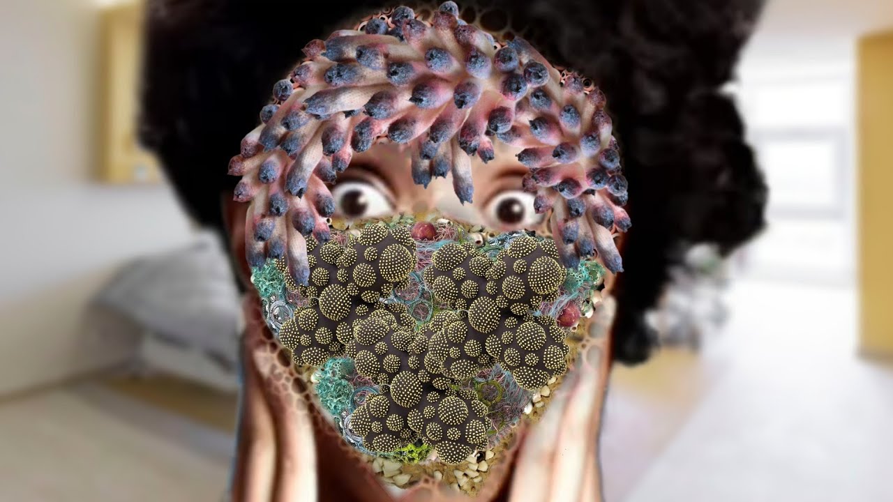 ASMR ANIMATION TREATMENT 🚑 Dog Ticks & Maggot Infected Face ...