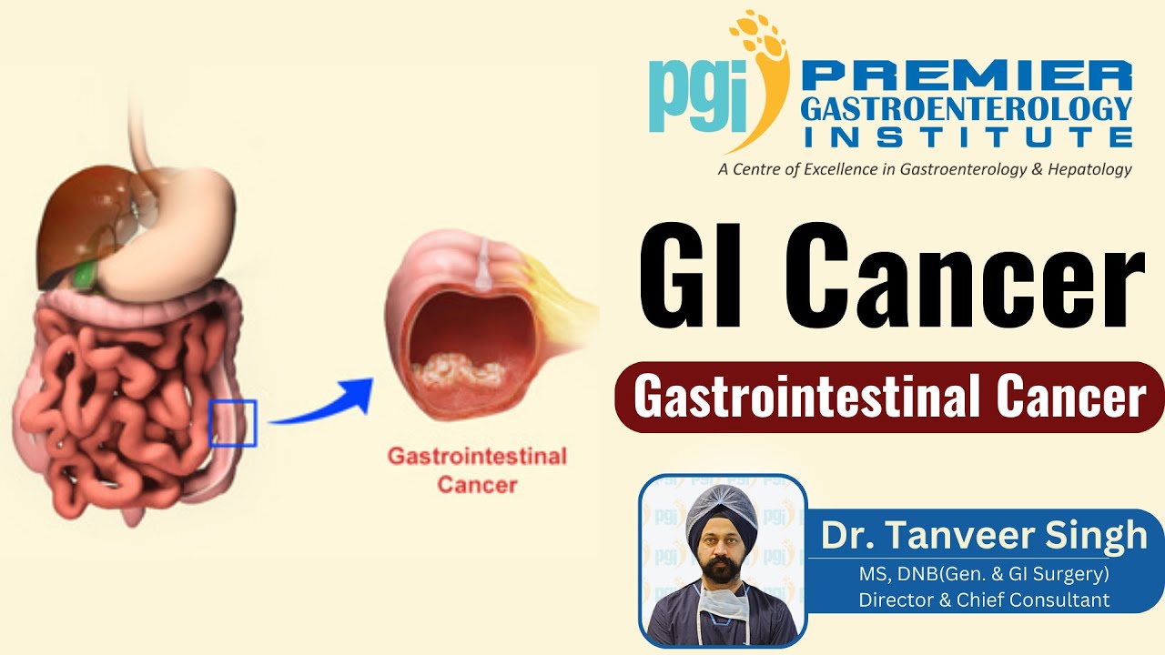 Gastrointestinal (GI) Cancer | Causes and Symptoms by Dr. Tanveer Singh ...