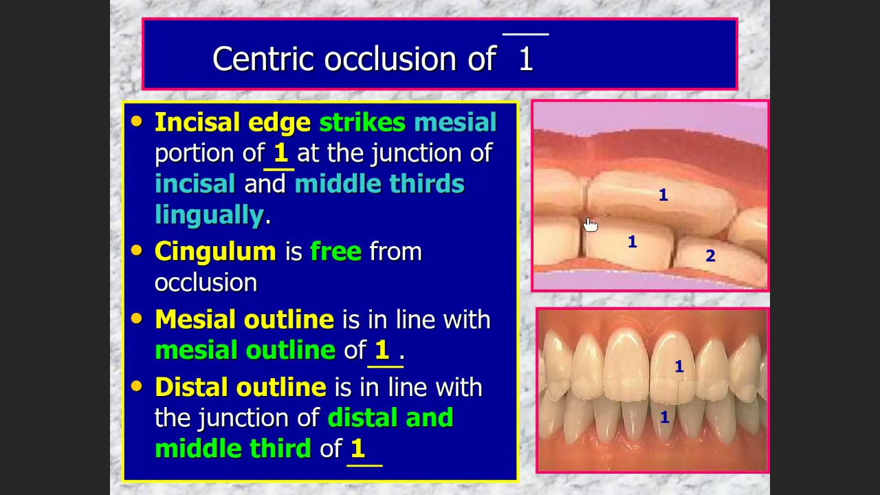 Dental Anatomy | 13-Occlusion - YouTube